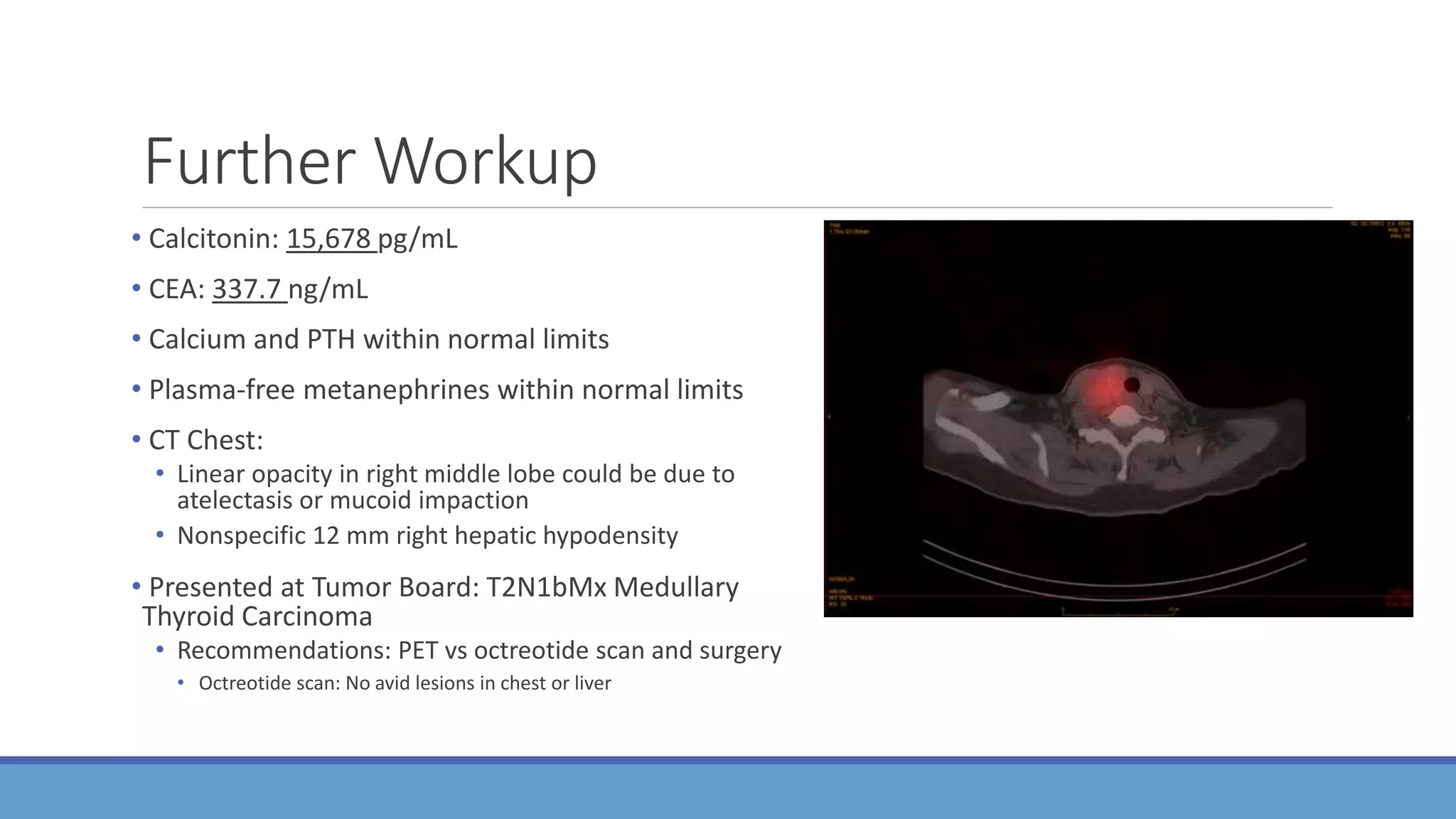 Medullary thyroid cancer | PPTX