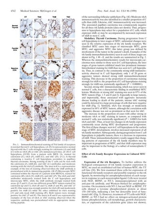 Medullary thyroid carcinoma | PDF