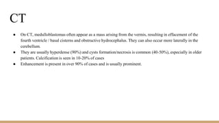 Medulloblastoma : clinical staging, molecular stratification and ...