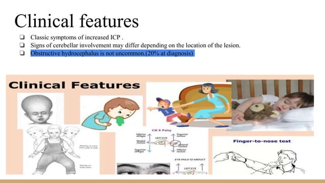 Medulloblastoma : clinical staging, molecular stratification and ...