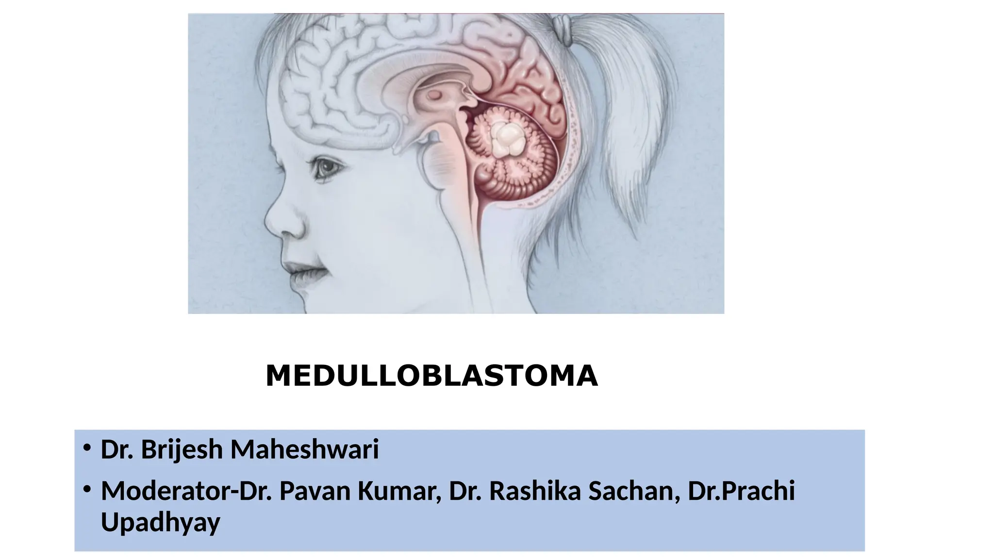Medulloblastoma ANATOMY TO MANAGEMENT WITH RADIOTHERAPY TECHNIQUES | PPTX