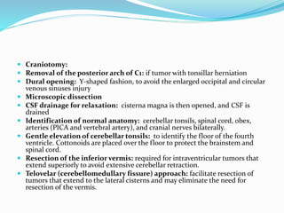 Medulloblastoma (Case presentation)dr.mumtaz a li | PPTX