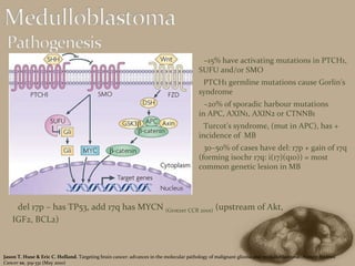 Medulloblastoma | PPT