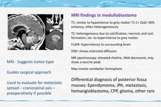 Medulloblastoma - A Closer Look | PPT