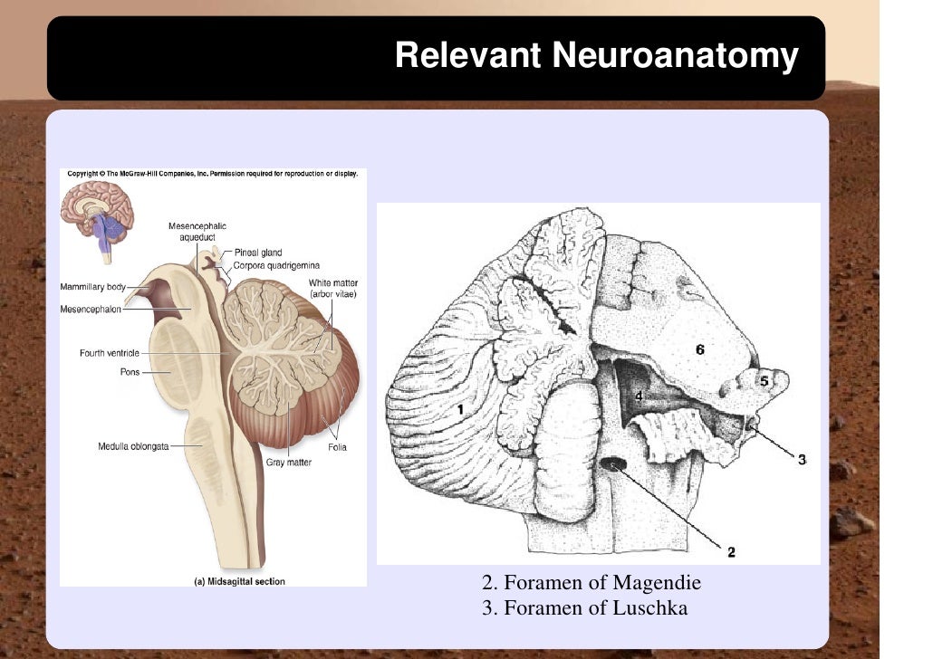 Medulloblastomas