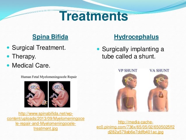 Meeting the needs of children and families PowerPoint