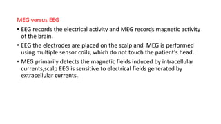 Magnetoencephalography | PPTX