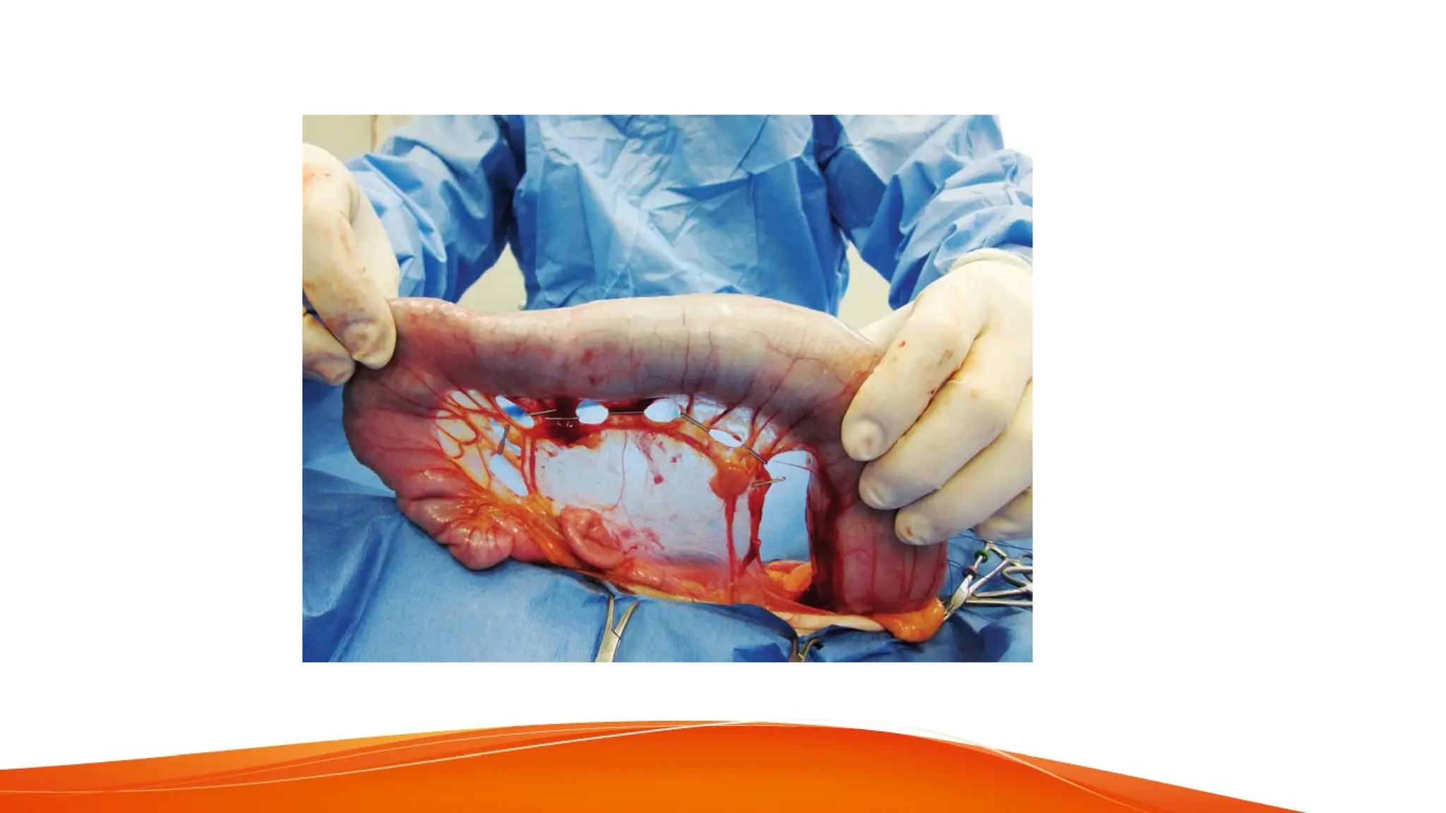 MEGACOLON animals & surgery,Treatment .pptx