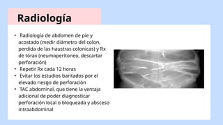Megacolon, definición, clasificación, clínica diagnóstico | PPTX