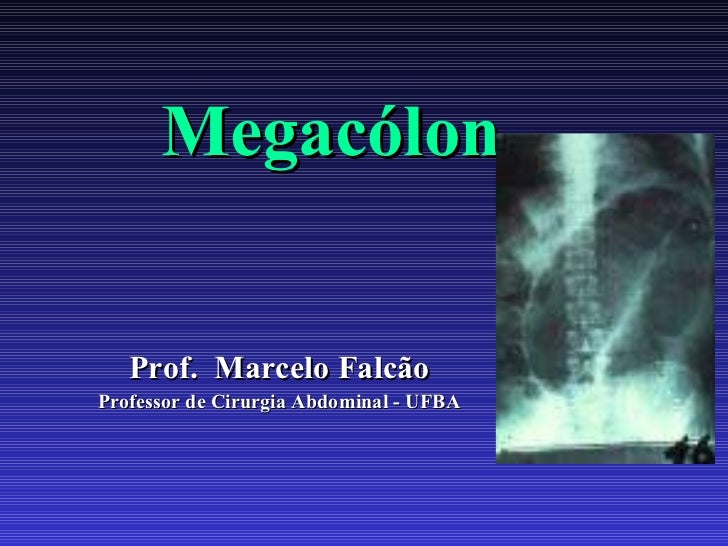 Megacolon ufba.
