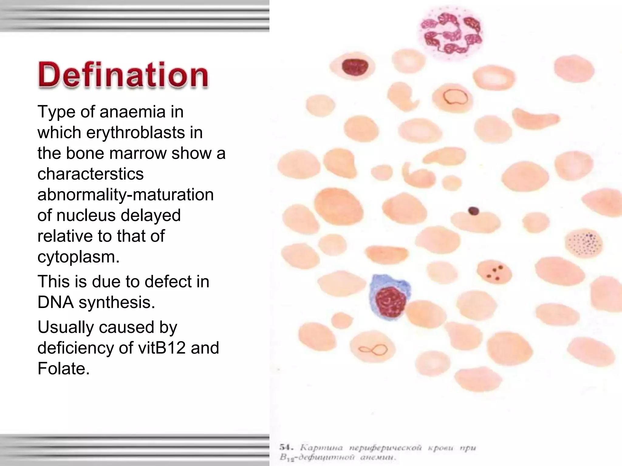 Megaloblastic anaemia | PPTX