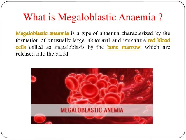 Megaloblastic Anaemia Symptoms Causes Diagnosis Treatment And Pre…