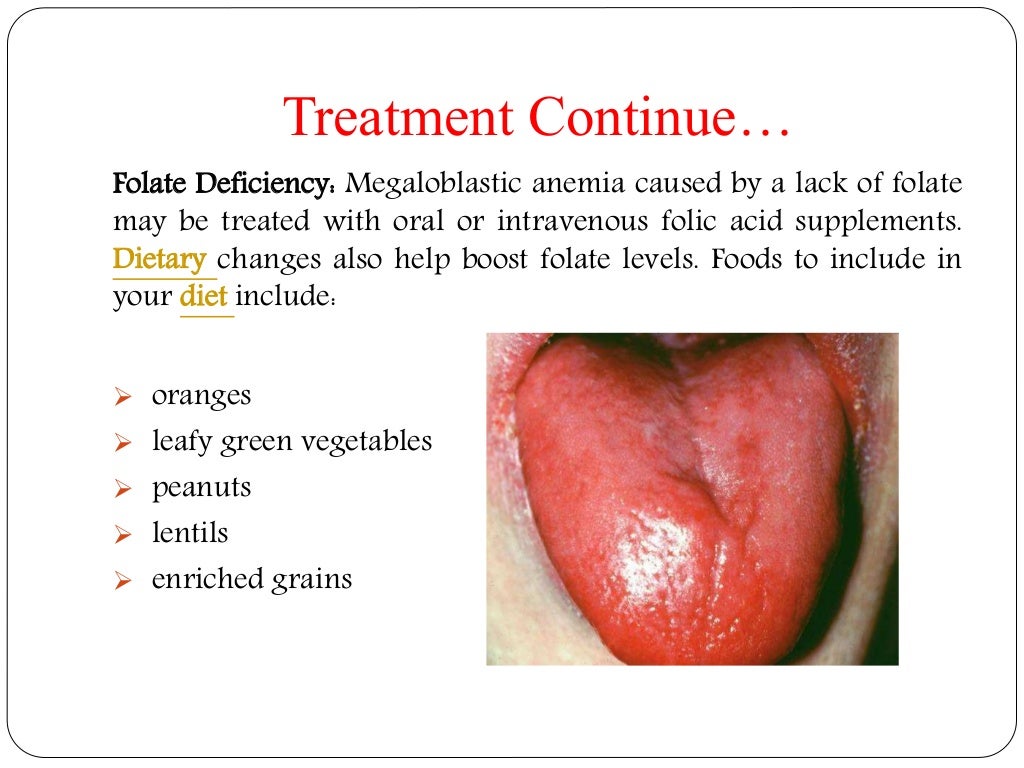 Megaloblastic Anaemia Symptoms Causes Diagnosis Treatment And Pre…