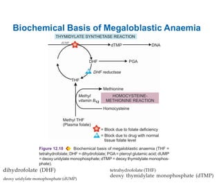 Megaloblastic anaemia . And all anout anaemia, pernicious anaemia, | PDF