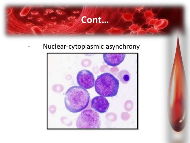 Megaloblastic anemia