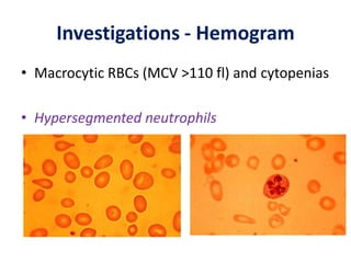 Megaloblastic anemia in childhood | PPTX