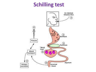 Megaloblastic anemia in childhood | PPTX