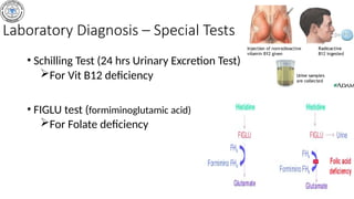 Megaloblastic Anemia in Biochemistry prospective | PPTX