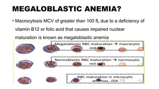 megaloblastic anemia and its causes.pptx