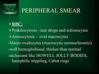 Megaloblastic Anemias Group-4.ppt