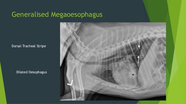 Megaoesophagus