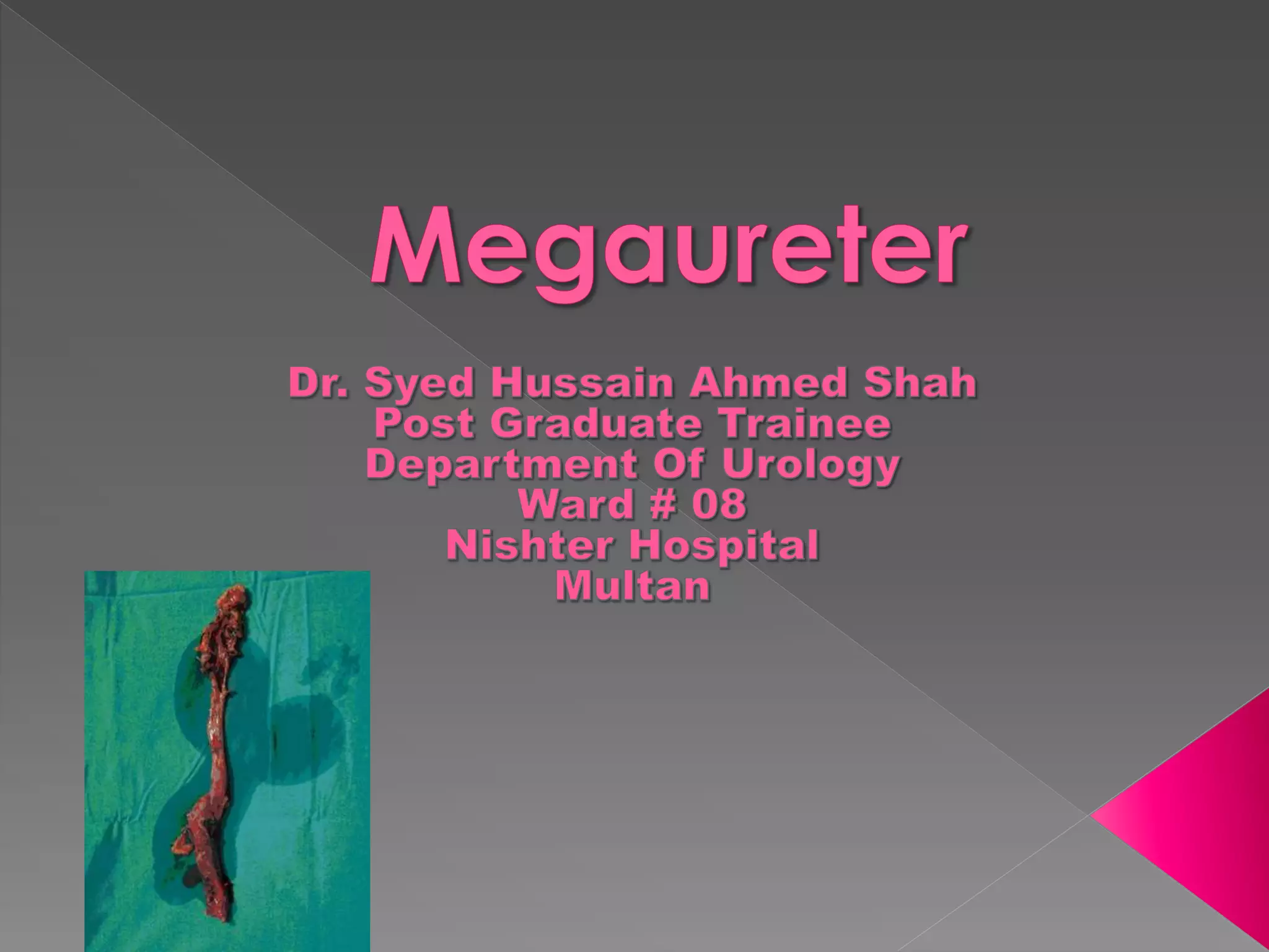 Megaureter ppt. Types, pathophysiology, evaluation and management. | PPTX