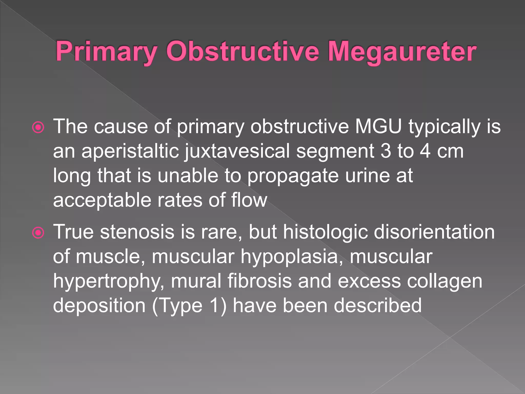 Megaureter ppt. Types, pathophysiology, evaluation and management. | PPTX