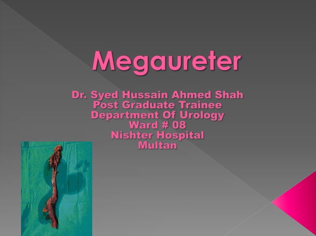 Megaureter ppt. Types, pathophysiology, evaluation and management ...