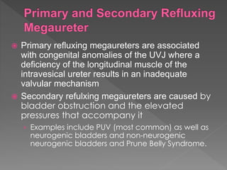 Megaureter ppt. Types, pathophysiology, evaluation and management. | PPTX
