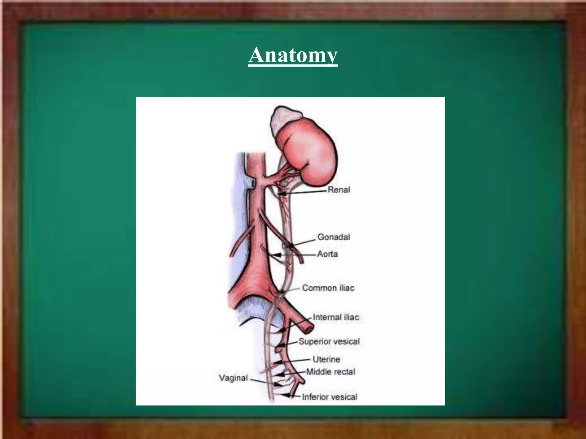 Megaureter | PPTX | Digestive Disorders | Diseases and Conditions