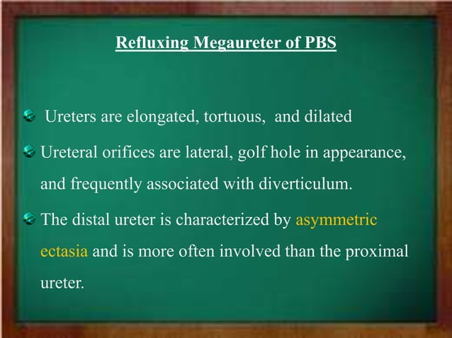 Megaureter | PPTX | Digestive Disorders | Diseases and Conditions