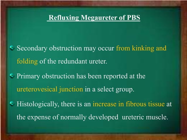 Megaureter | PPTX | Digestive Disorders | Diseases and Conditions