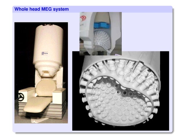 MEG recording of brain signals | PDF