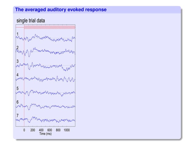 MEG recording of brain signals | PDF