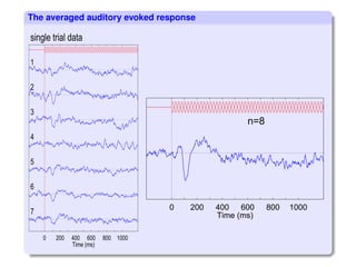 MEG recording of brain signals | PDF