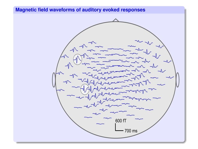 MEG recording of brain signals | PDF