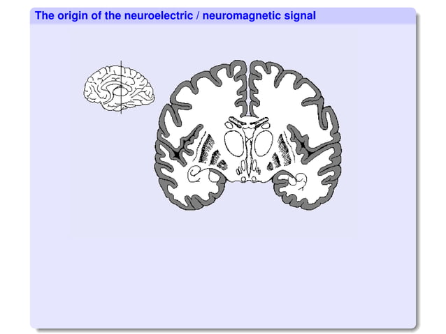MEG recording of brain signals | PDF