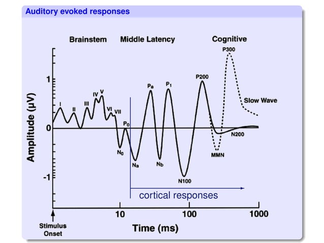 MEG recording of brain signals | PDF