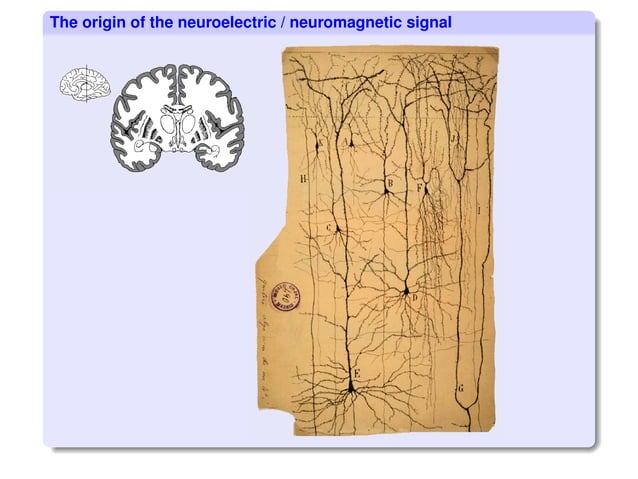 MEG recording of brain signals | PDF