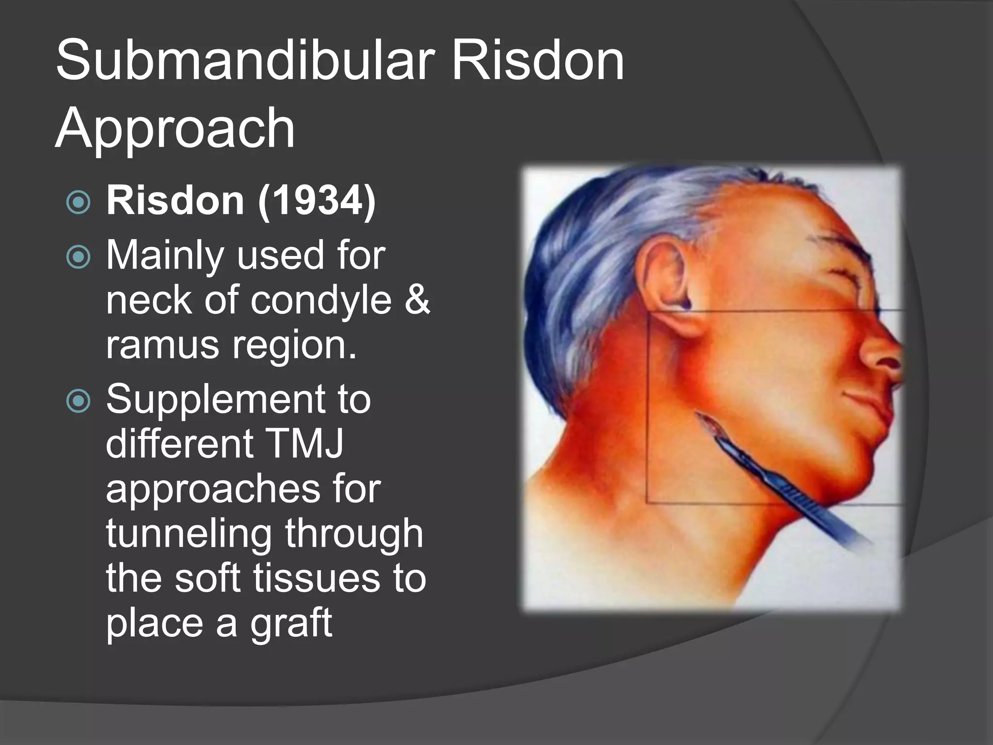 Anatomy of Temporomandibular Joint | PPSX
