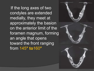 Anatomy of Temporomandibular Joint | PPSX