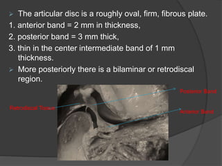 Anatomy of Temporomandibular Joint | PPSX