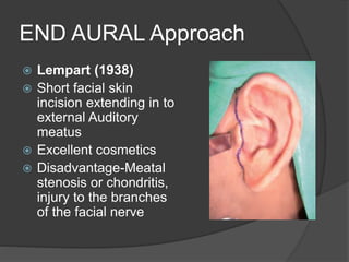 Anatomy of Temporomandibular Joint | PPSX
