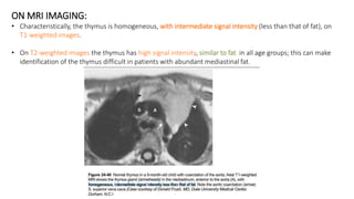 Radioanatomy of mediastinum and approach to mediastinal masses | PPTX