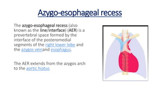 Radioanatomy of mediastinum and approach to mediastinal masses | PPT