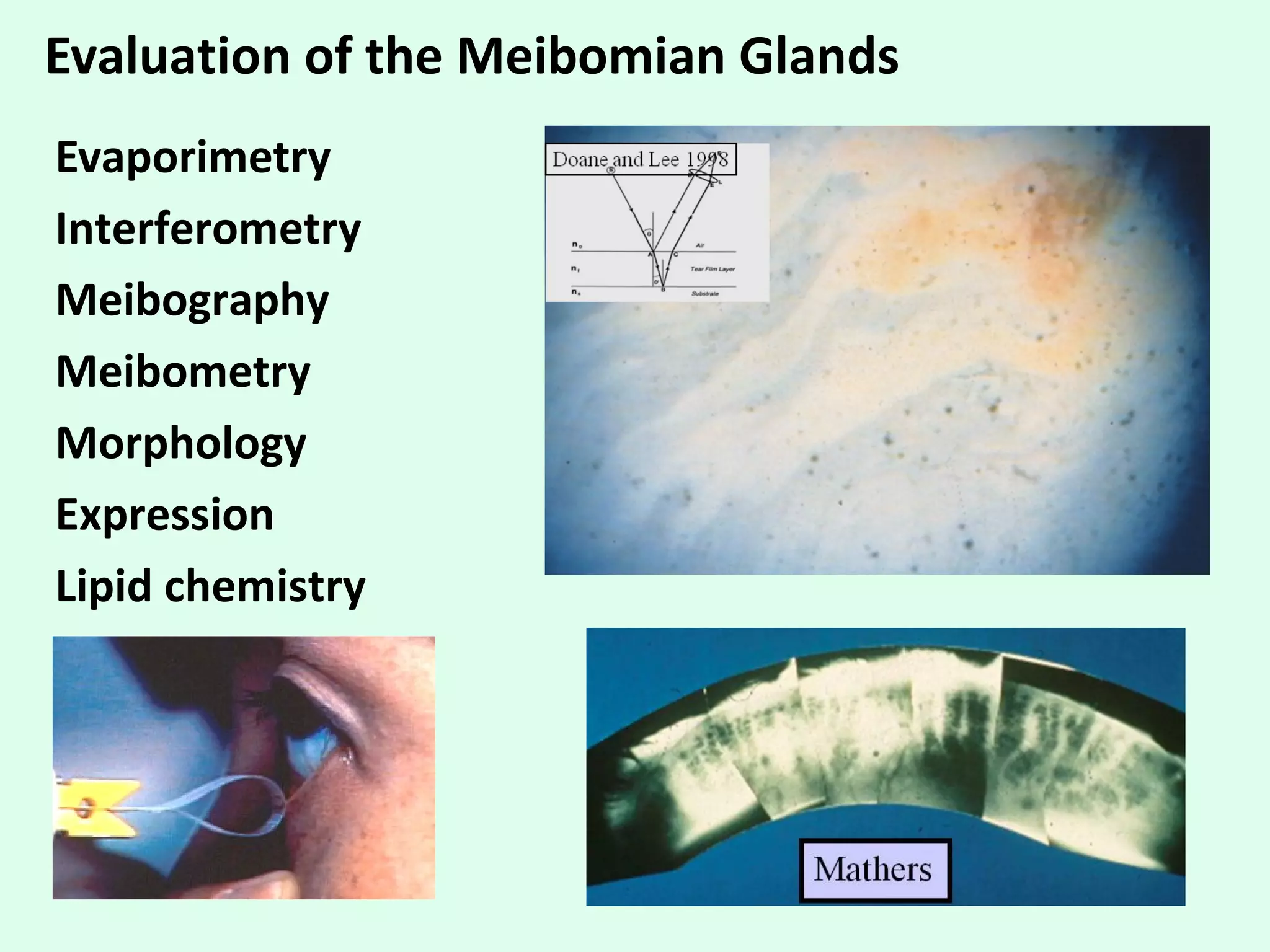 Prof Bron lecture. The A-Z of MGD | PPT