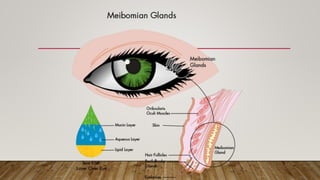 MEIBOMIAN GLAND DYsfunction.pptx | Eye and Vision Conditions | Diseases ...