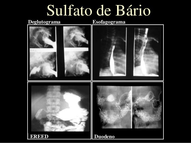 Meios de contraste 2