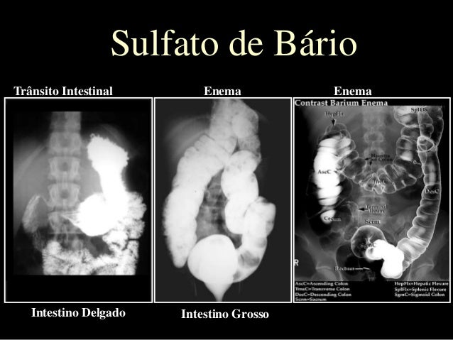 Meios de contraste 2