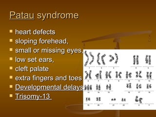 Meiosis mistakes | PPT